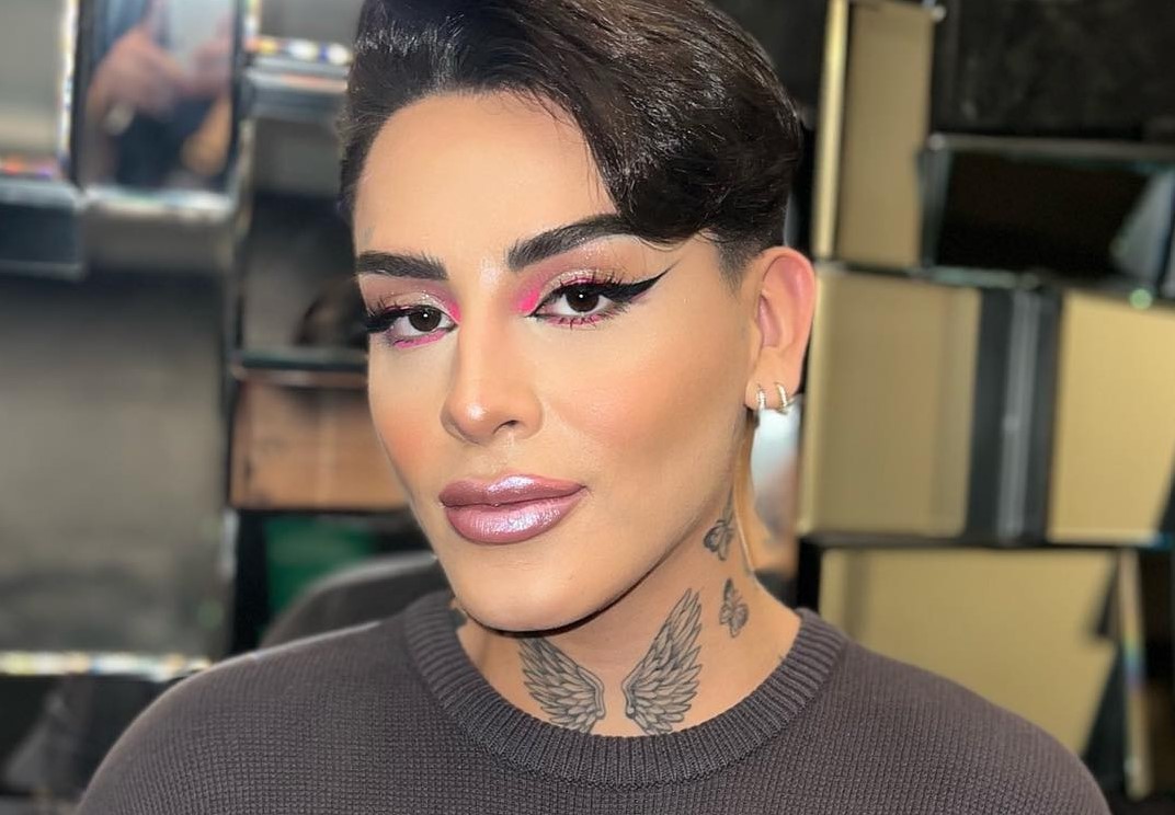 Así lucía el influencer Kunno antes de sus cirugías